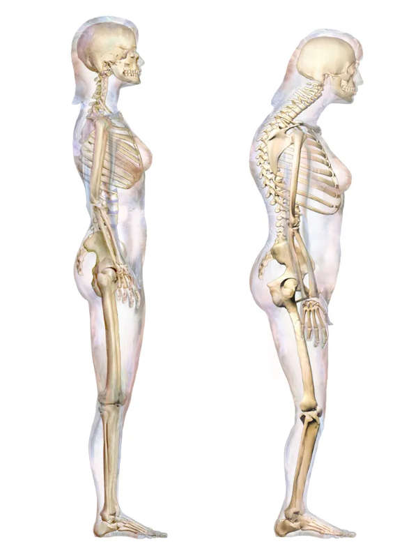 Nerd Neck: Easy Ways to Correct Forward Head Posture - Inkcue Nerd Neck: Easy Ways to Correct Forward Head Posture - Inkcue
