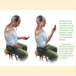 Nerd Neck: Easy Ways to Correct Forward Head Posture - Inkcue